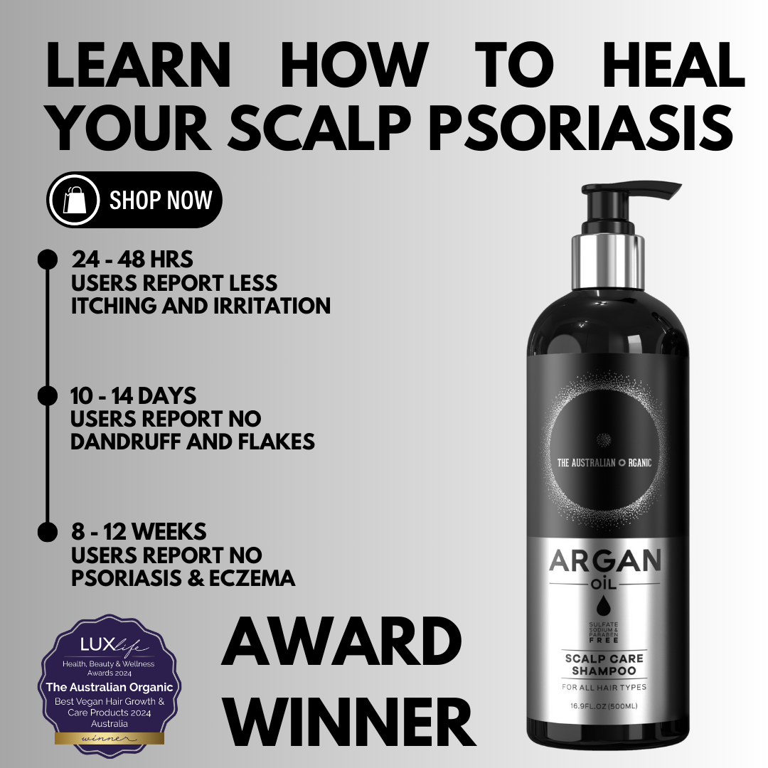 Scalp & Body Care For Your: Psoriasis, Eczema, Itching, Sores, Scabs